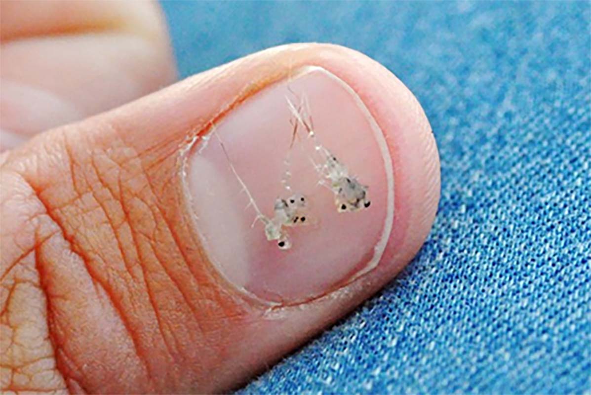 Facts and FAQs about AIS - Riding Mountain National Park